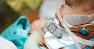 Tracheostomy Procedure