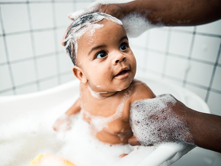 Home remedies and treatment for cradle cap