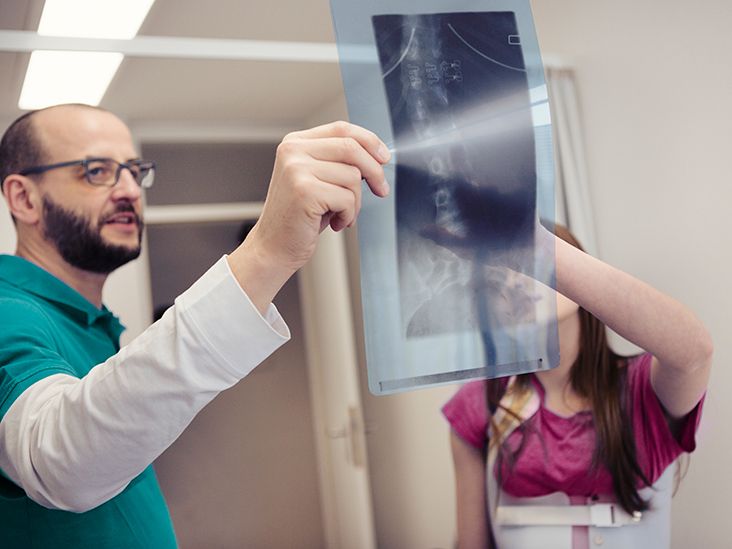 Neuromuscular Scoliosis: Causes and Treatment