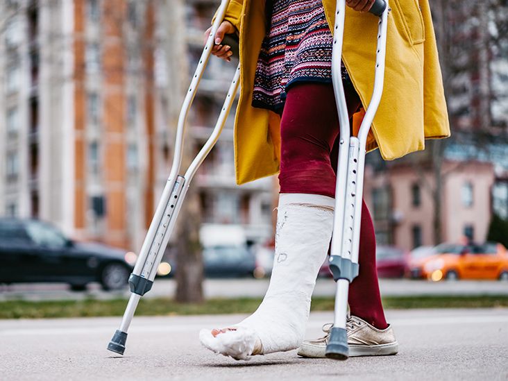 Posterior Malleolus Fracture: Definition, Treatment, and Recovery