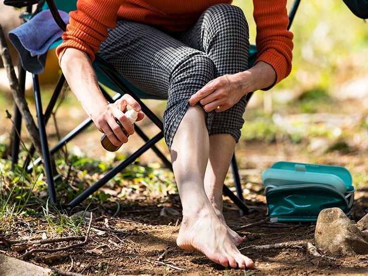 Chigger Bites: What They Look Like, Treatment, and More