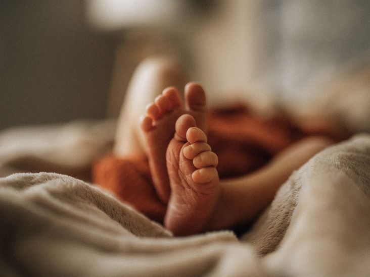 Meconium Ileus in Newborns with Cystic Fibrosis