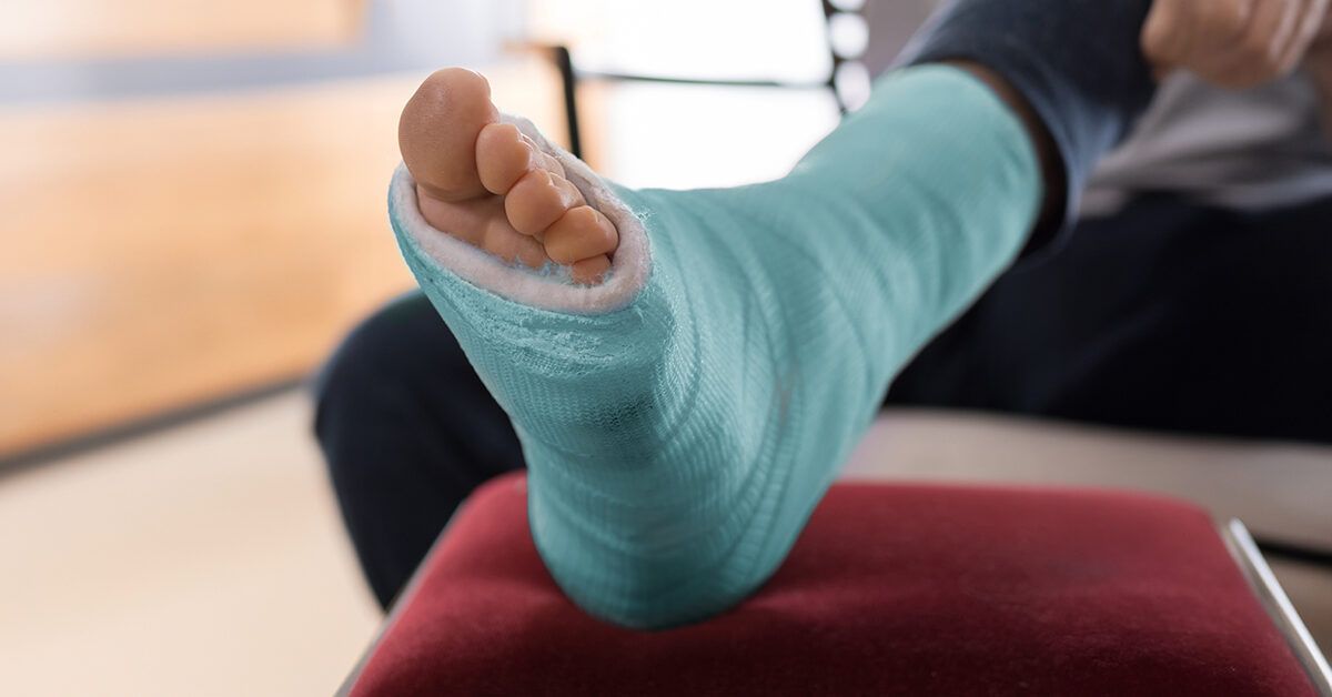 What You Need to Know About Ankle Surgery Recovery
