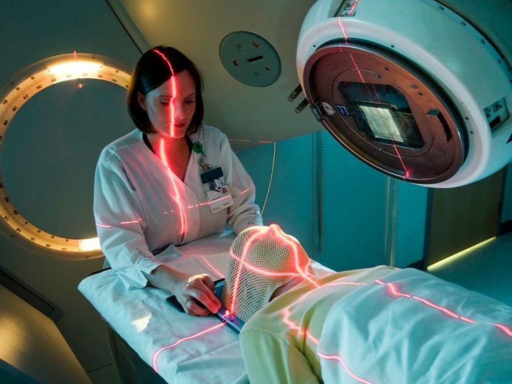 Your Guide to Radiation Therapy for Tongue Cancer
