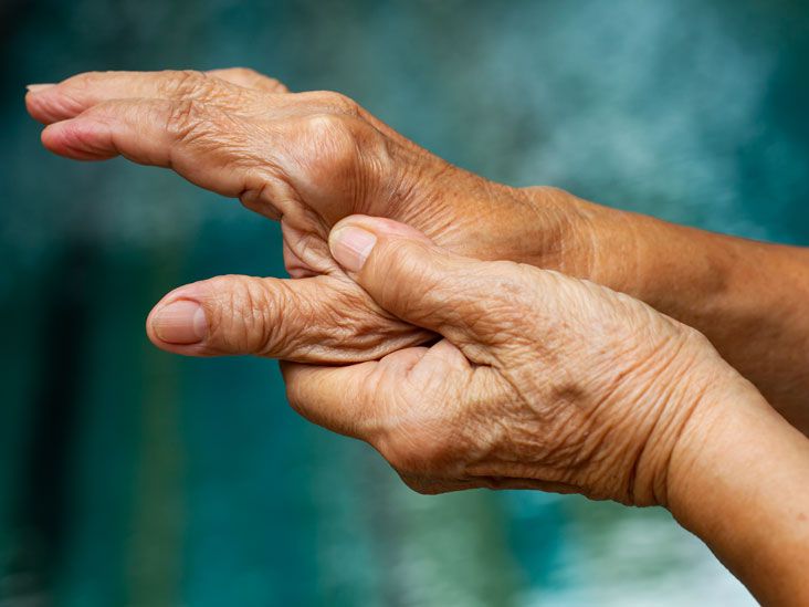 Carpometacarpal Arthritis: Symptoms, Causes, Diagnosis, and Treatment
