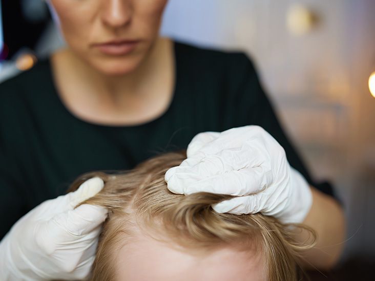 How to Remove Nits from Hair Without a Comb