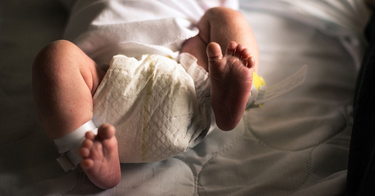 Aicardi-Goutières Syndrome: Symptoms, Causes, Treatment, and More