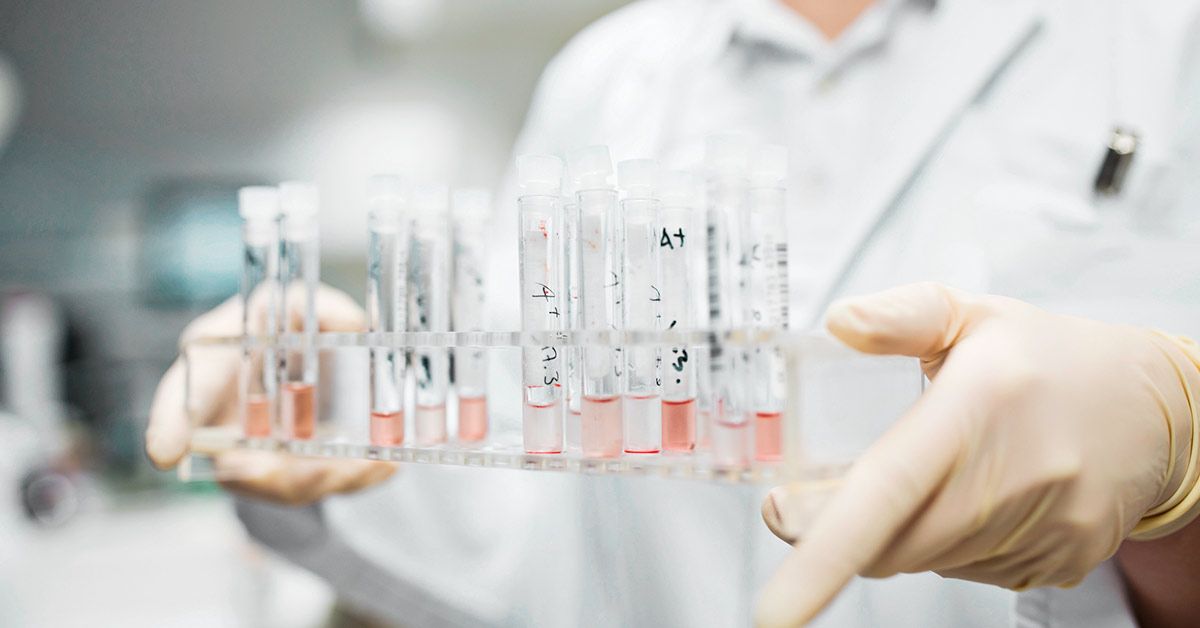 Alpha- vs. Beta-Thalassemia: Types, Symptoms, and More