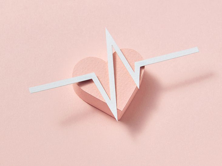 New-Onset AFib: Causes, Symptoms, and Treatment