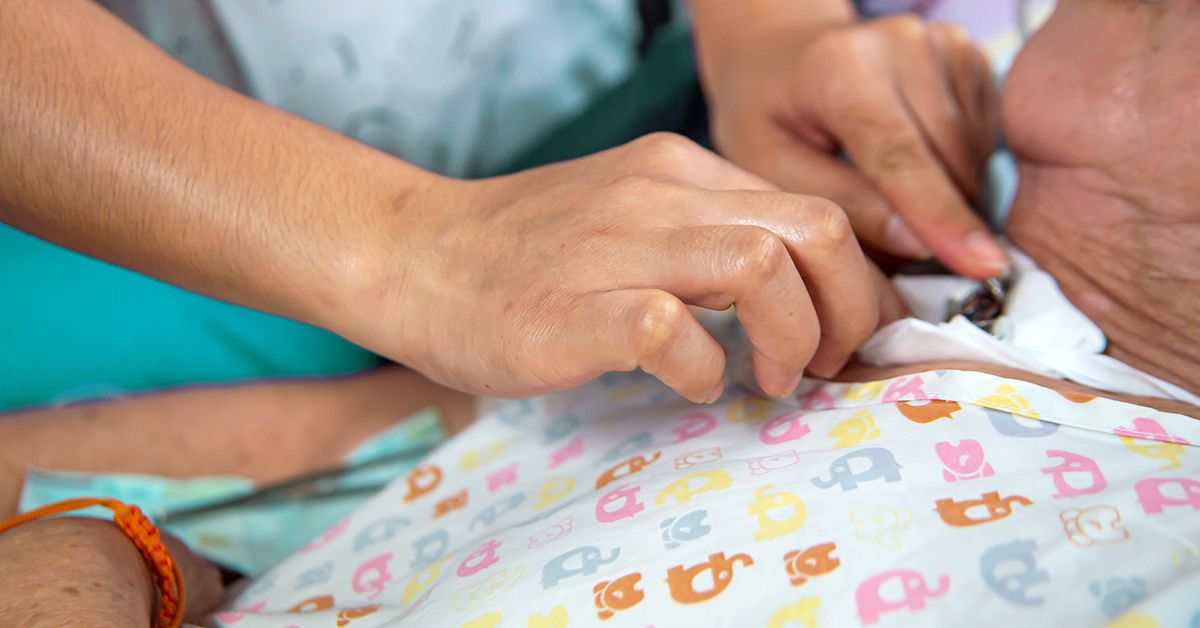 Ways to Reduce Tracheostomy Secretions