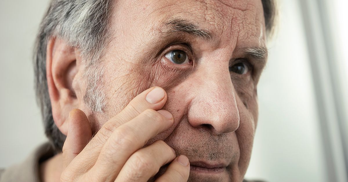 Shingles Complications and How to Treat Them