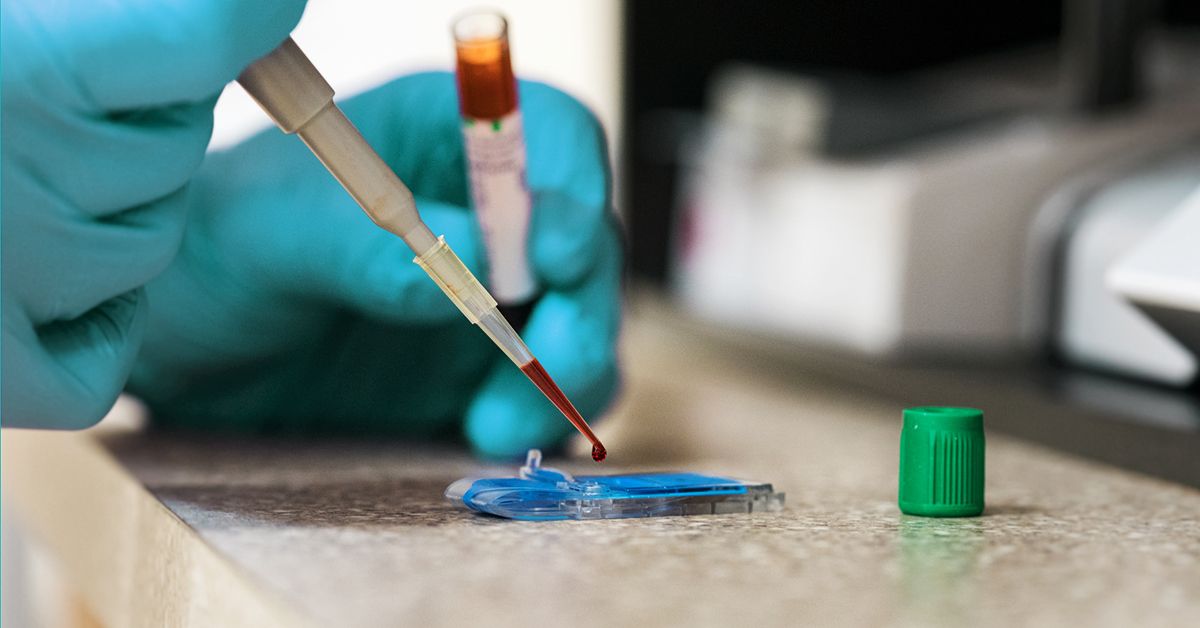 What Is a Complete Blood Count (CBC) for Aplastic Anemia?