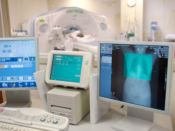 Benign Lung Nodules: Symptoms, Causes, and Treatment
