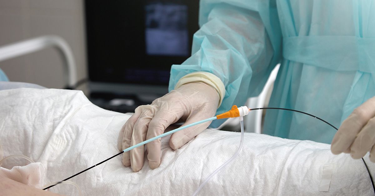 Thrombectomy and Thrombolysis: What’s the Difference?