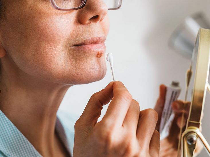 Raised Skin Bumps: Pictures, Types, Causes, and Treatment