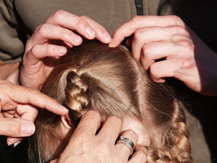 Fleas On Humans Hair