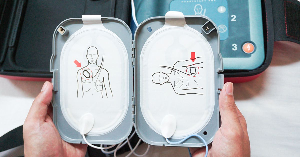 How to Use a Defibrillator: Steps and FAQ