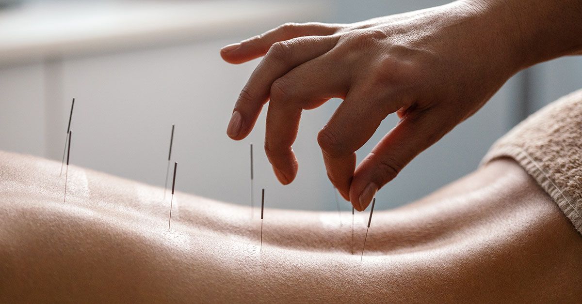 Acupuncture for Sacroiliac (SI) Joint Pain: Effectiveness and More
