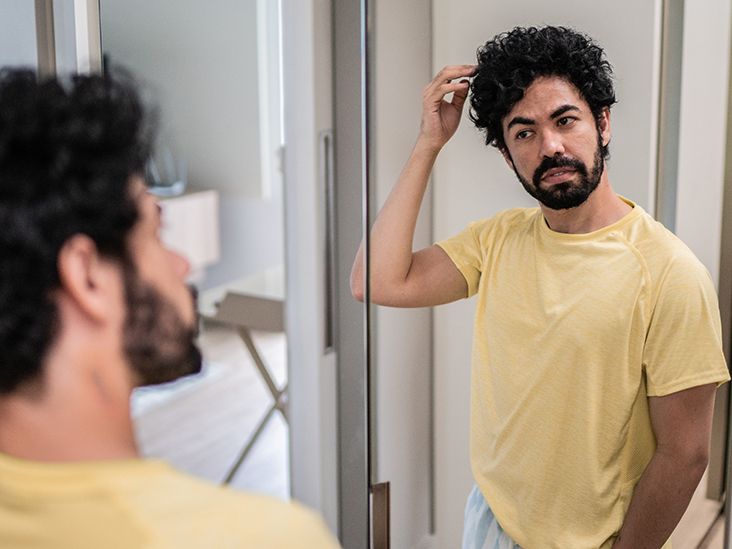 Receding Hairline: Stages, Causes, and Treatments