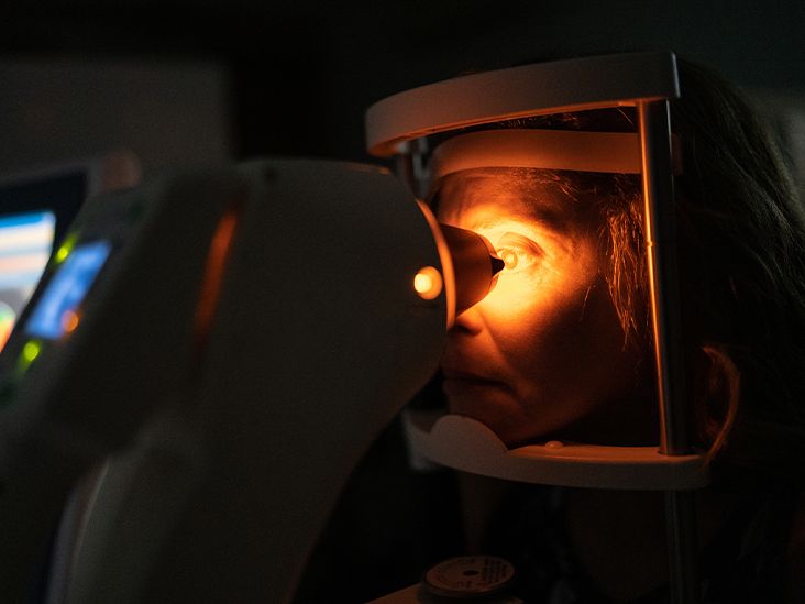Posterior Subcapsular Cataract: Causes, Symptoms, Treatment