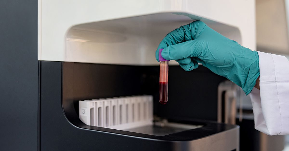 Blood Tests for EPI: How the Condition is Diagnosed