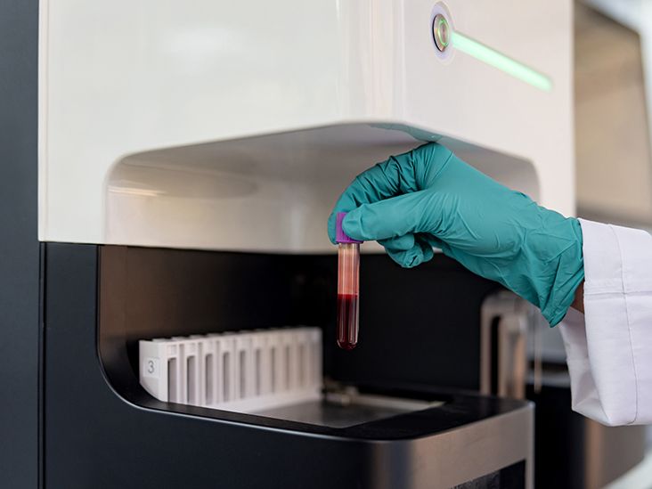 Blood Tests for EPI: How the Condition is Diagnosed