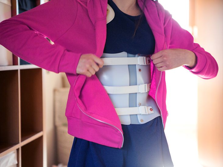 Scoliosis Rib Hump: What It Is and How to Treat It