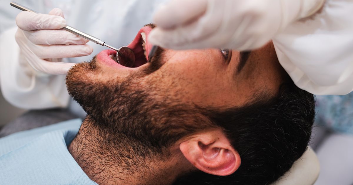 Hard Palate Cancer: Symptoms, Causes, Diagnosis, and Treatment