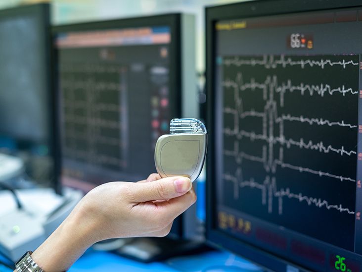 Arrhythmia Treatment: Medications, Procedures, and Devices