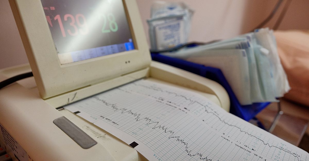 Understanding Paroxysmal Atrial Tachycardia (PAT)
