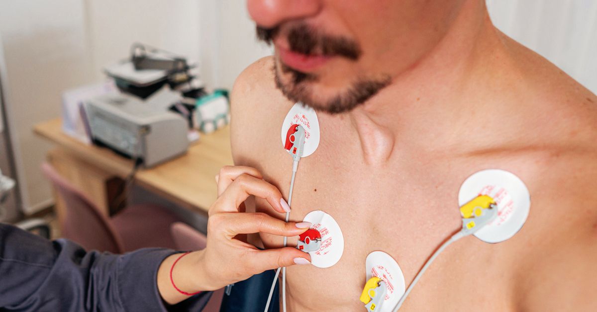 Junctional Escape Rhythm: Symptoms, Causes, Diagnosis, and Treatment