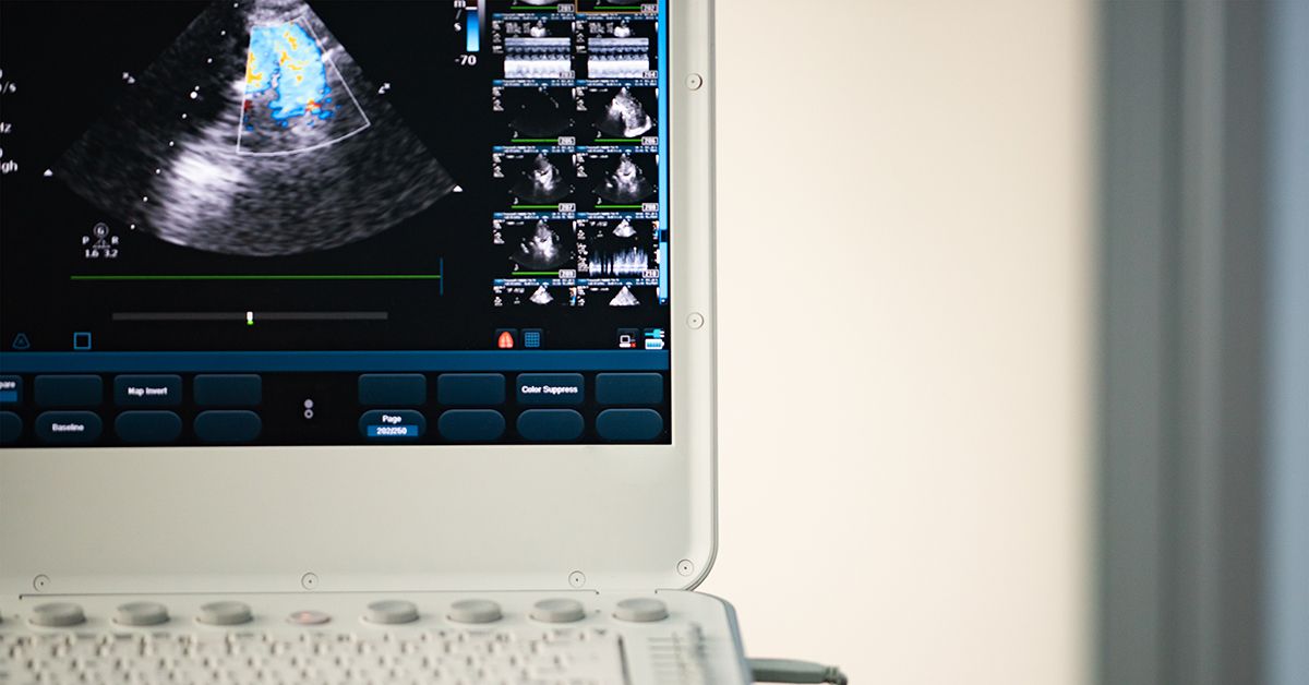 Medicare and Echocardiogram: Coverage Details