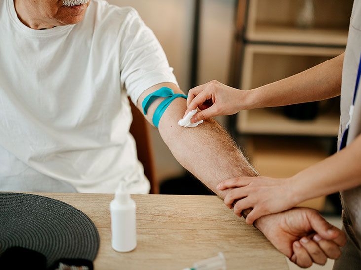 CLL and Thrombocytopenia: Causes, Symptoms, and Treatment