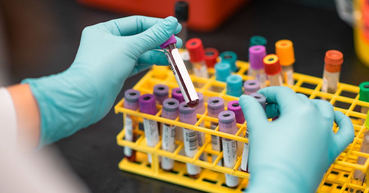 Parathyroid Hormone (PTH) Test: Procedure, Risks, Evaluating Results