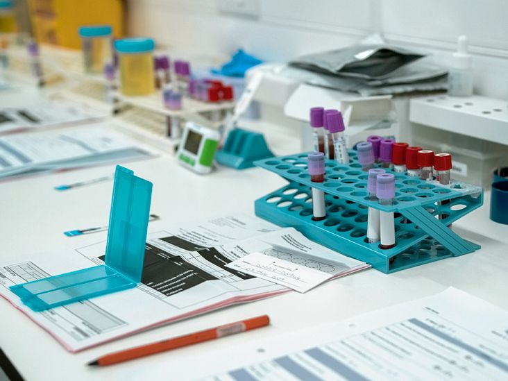 Prothrombin Gene Mutation: Testing, Complications, Treatment