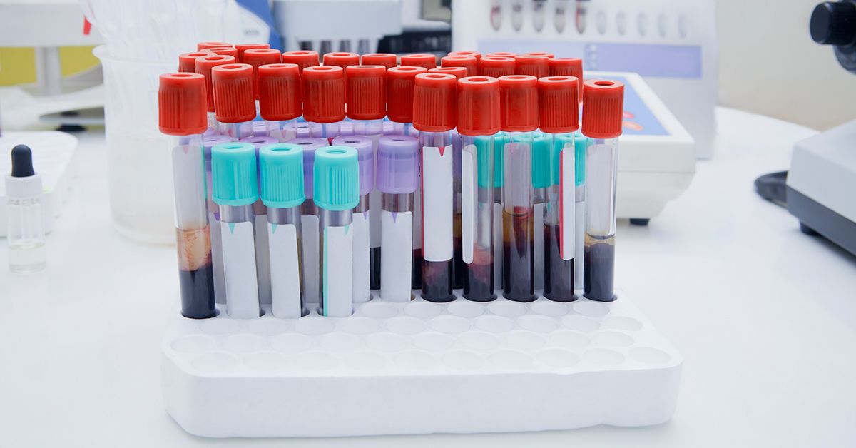 Hemophilia Labs: Clotting Factor Tests, APTT, PT, and more