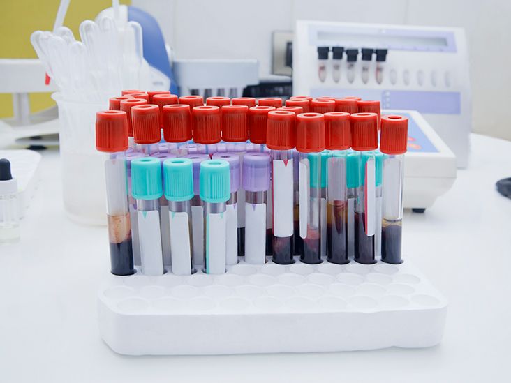 Hemophilia Labs: Clotting Factor Tests, APTT, PT, and more