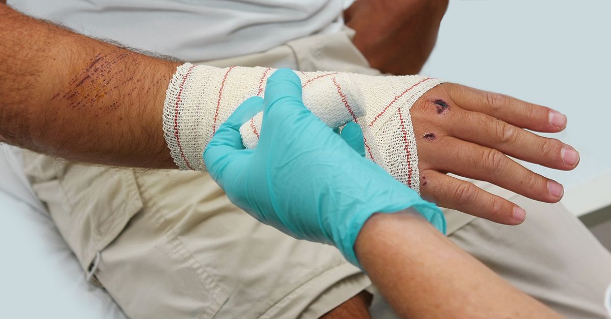 What Is a Full Thickness Skin Graft?