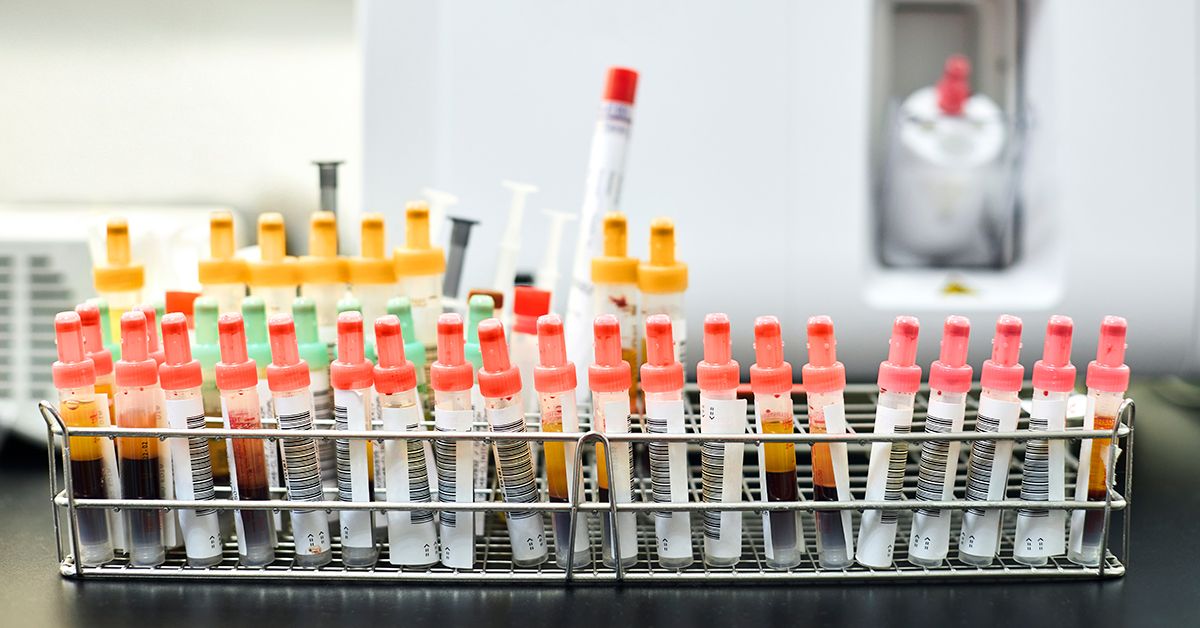 Multiple Myeloma Blood Tests: Purpose, Procedure, and Results