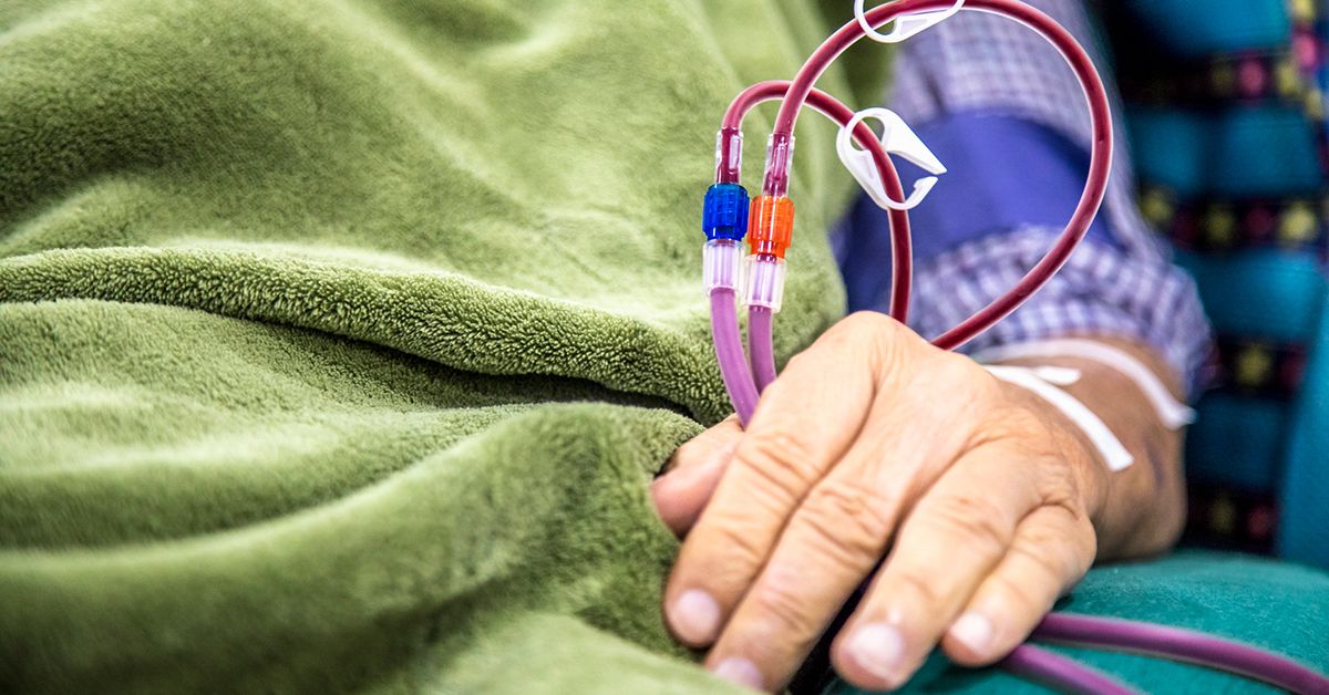 Hemodialysis and Kidney Disease