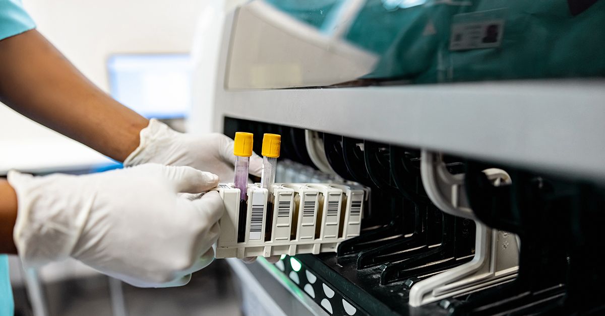 PSA Testing and Medicare: Eligibility, Coverage, and Costs