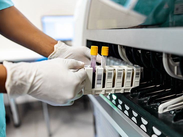 PSA Testing and Medicare: Eligibility, Coverage, and Costs