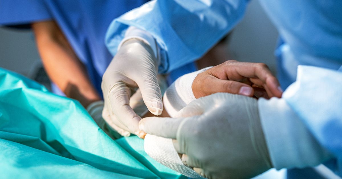Hand Reconstruction Surgery: Types, Effectiveness, and Risks