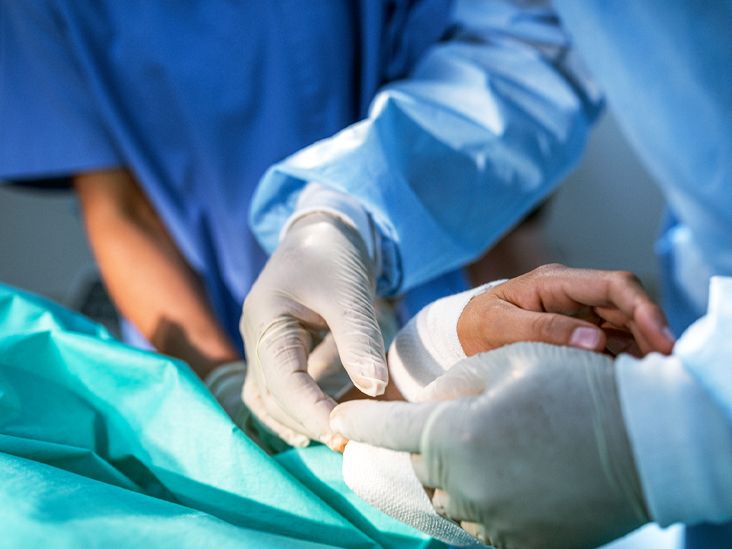 Hand Reconstruction Surgery: Types, Effectiveness, and Risks