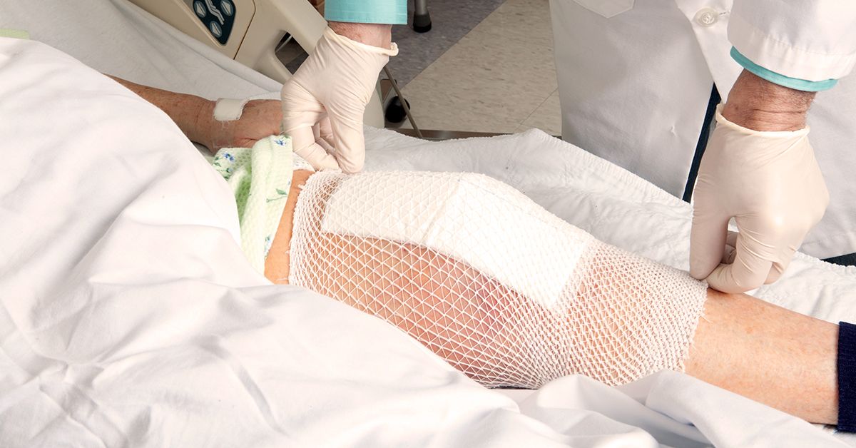 Fish Skin Grafts: Uses, Benefits, Risks, and Outlook