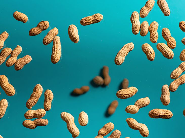 Peanut Allergy Treatment: Your Options