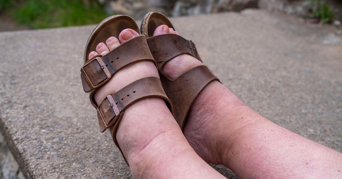 5 Signs Of Peripheral Edema And How To Fix It Familial Thoracic Aortic