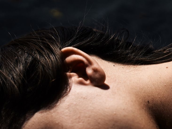 How Common Is Ear Pain After Tonsillectomy?