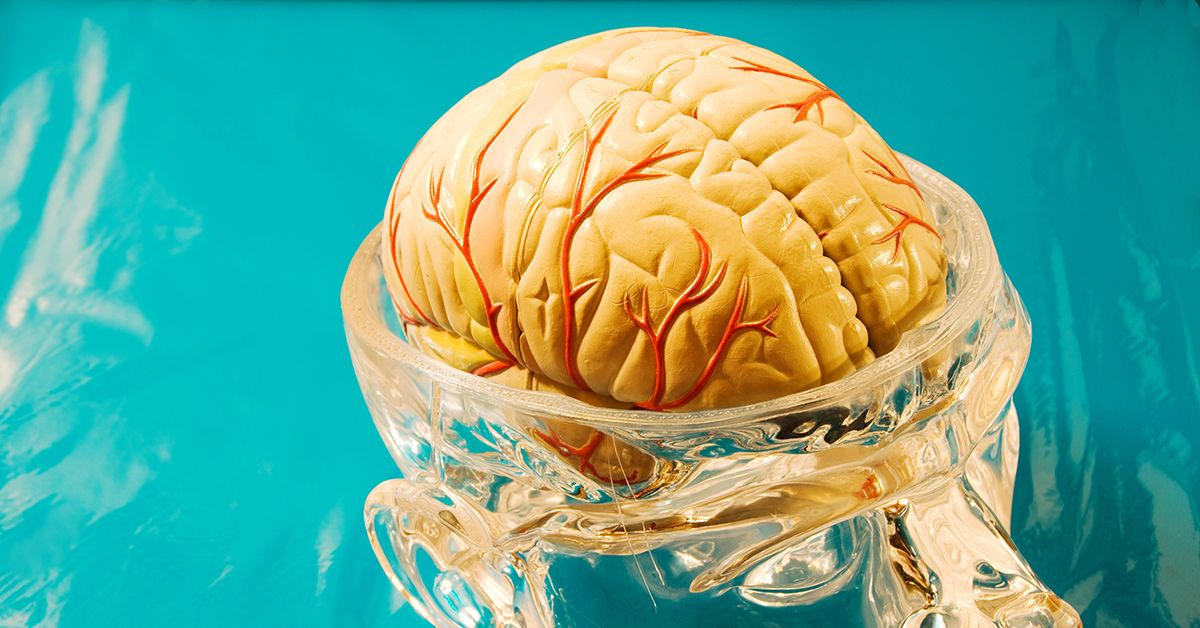 Brain Aneurysm Coiling: Procedure, Risks, Benefits, and More