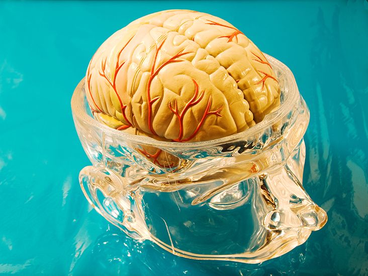 Brain Aneurysm Coiling: Procedure, Risks, Benefits, and More